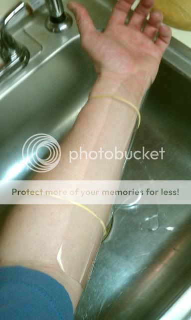 Homemade/Improvised SAM Splint | Bushcraft USA Forums